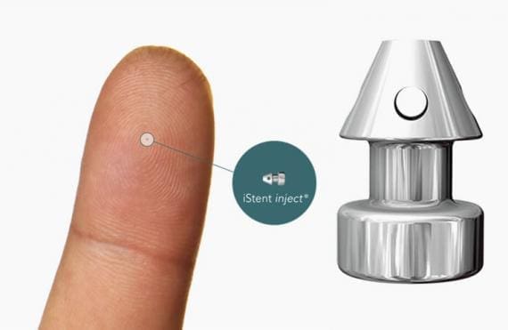What Is iStent? Glaucoma Treatment Explained